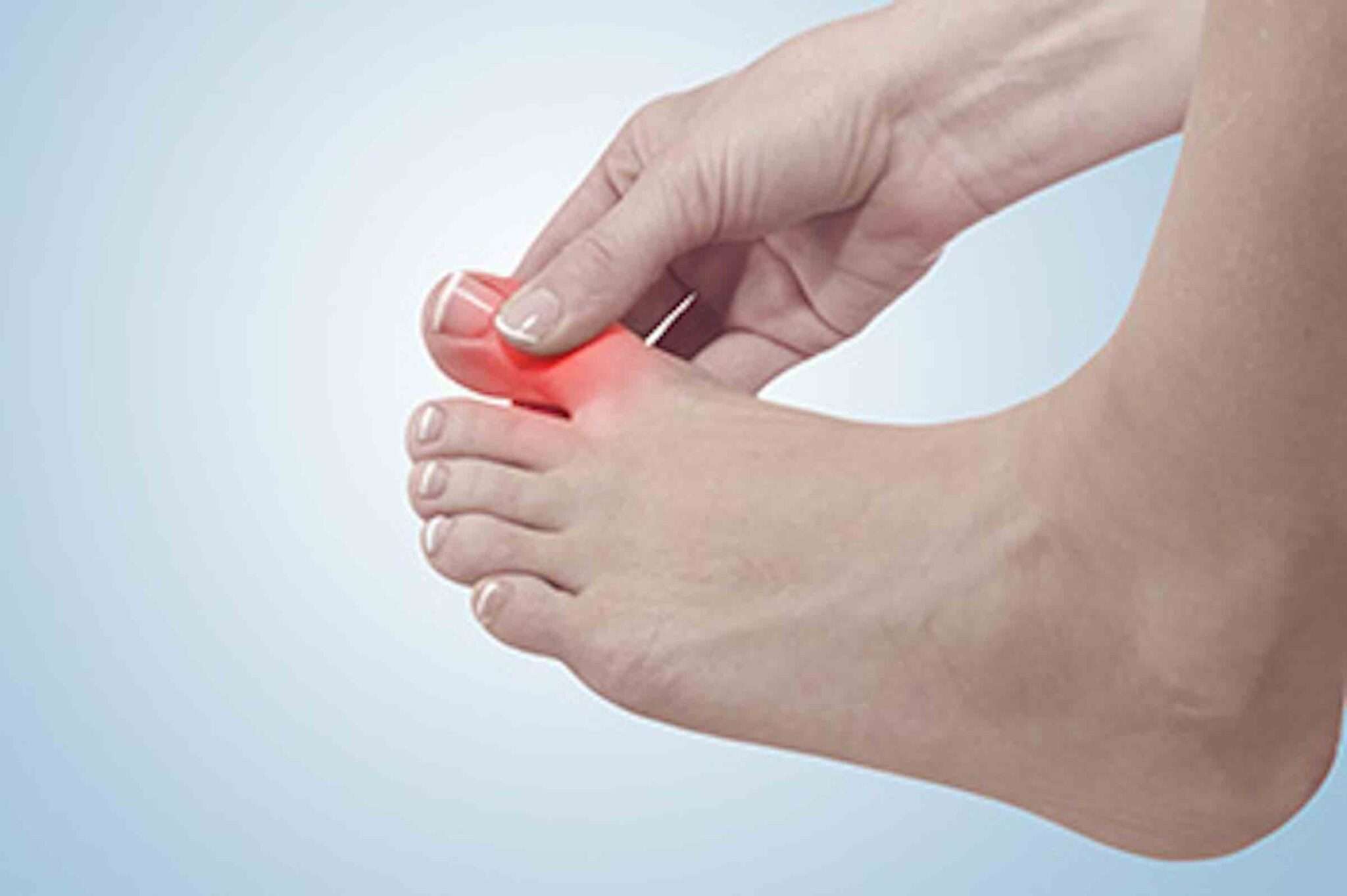 Turf Toe Treatment | Leading Health Podiatry
