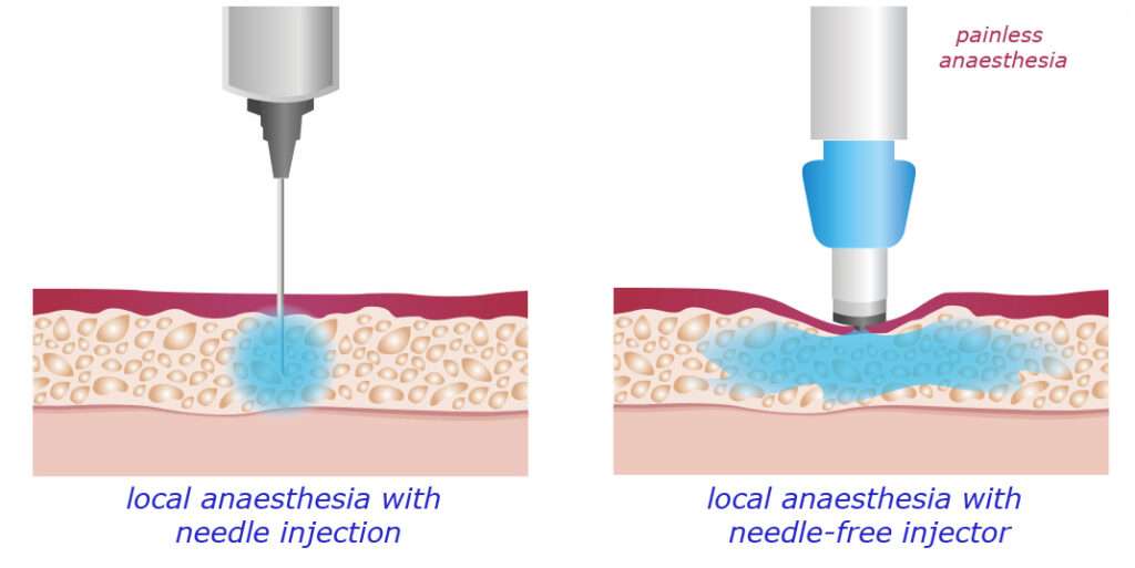 Our Highly Trained Podiatrist Can Perform Ingrown Toenail Surgery ...